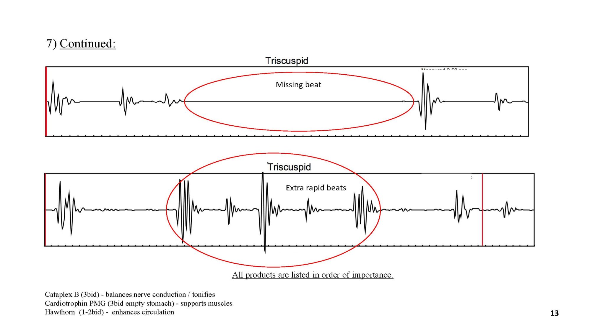 Heart Sound Recorder - East Cobb Spine & Sport Chiropractic